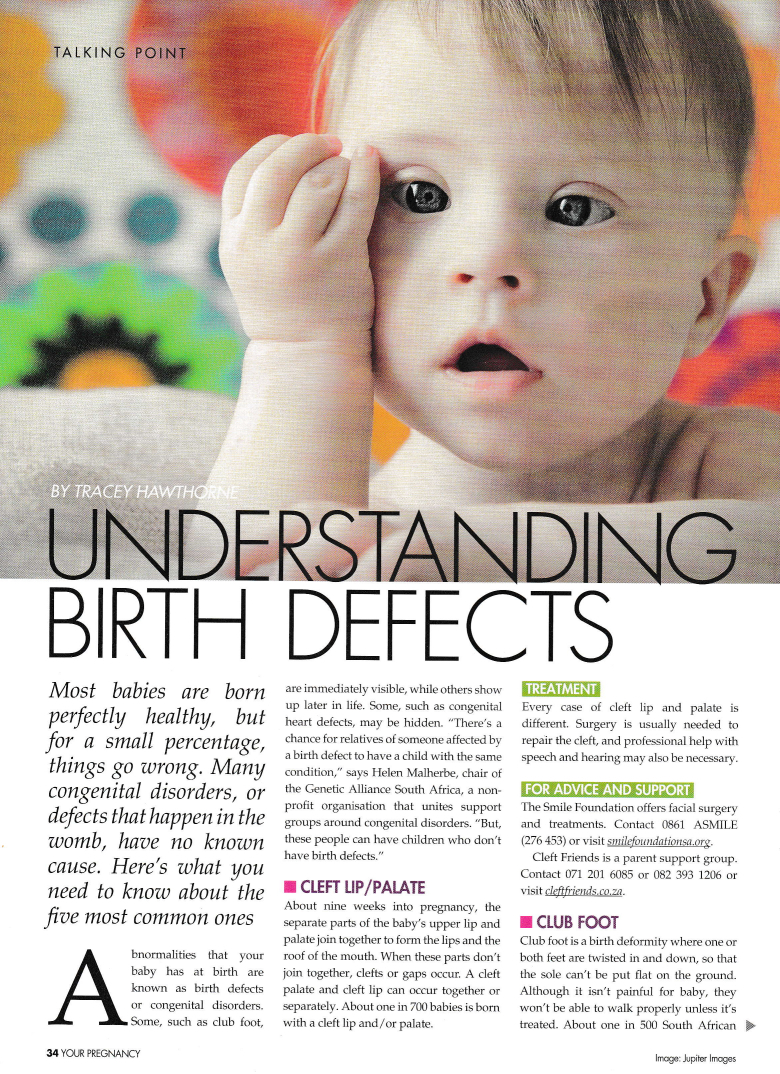 Understanding Birth Defects Steps Clubfoot Support In Southern Africa